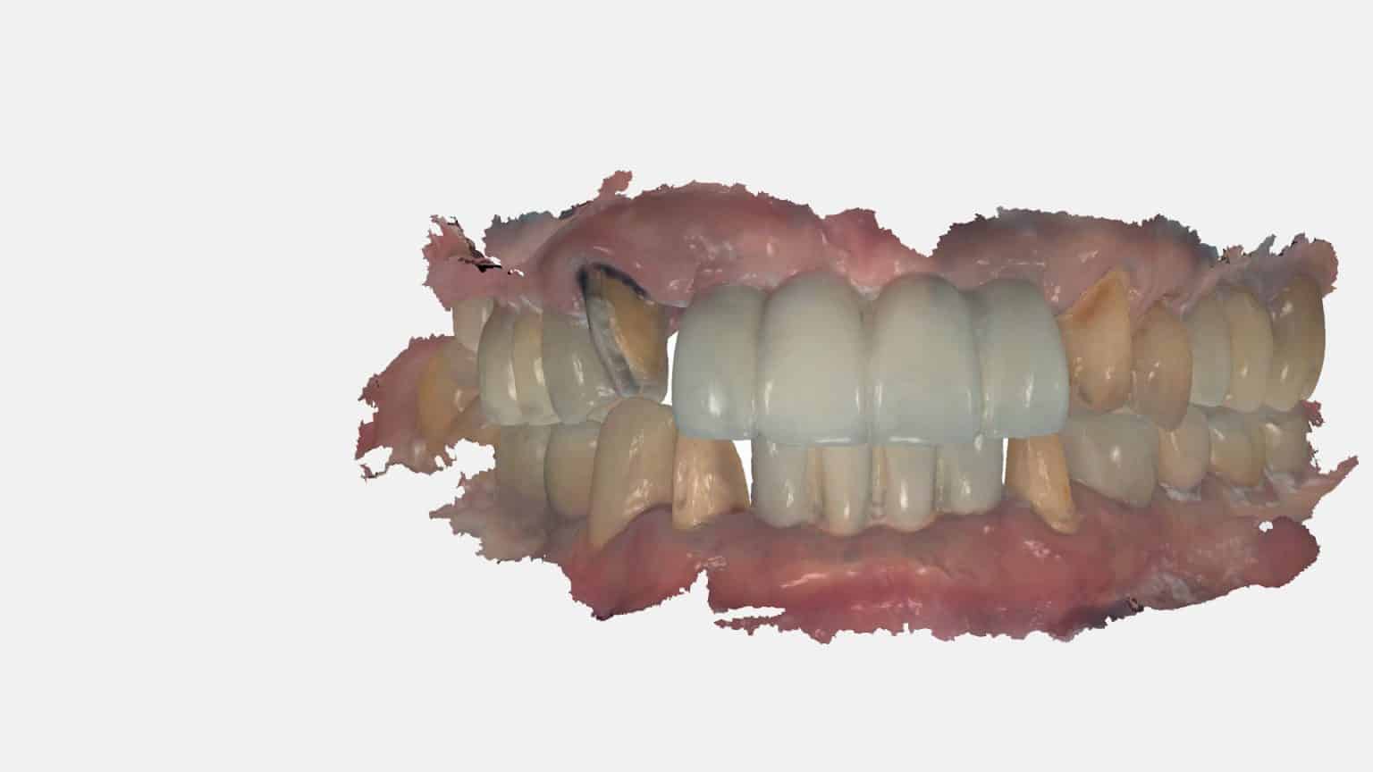 Already Scanning Practices - Method Dental Labs