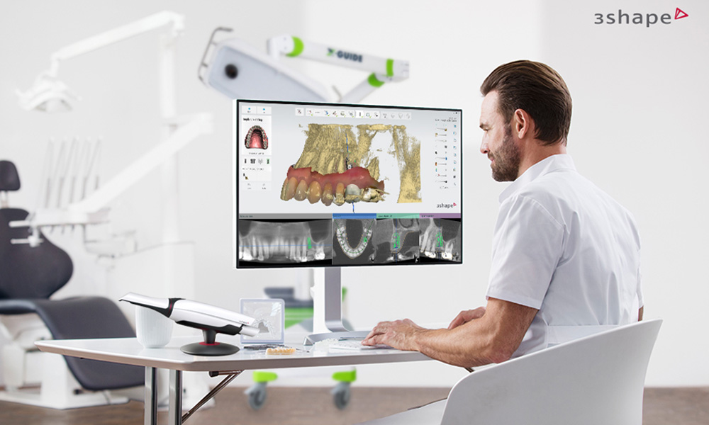 Custom Abutments - Method Dental Labs