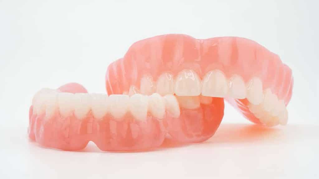 Digital Diagnostic Wax-up - Method Dental Labs